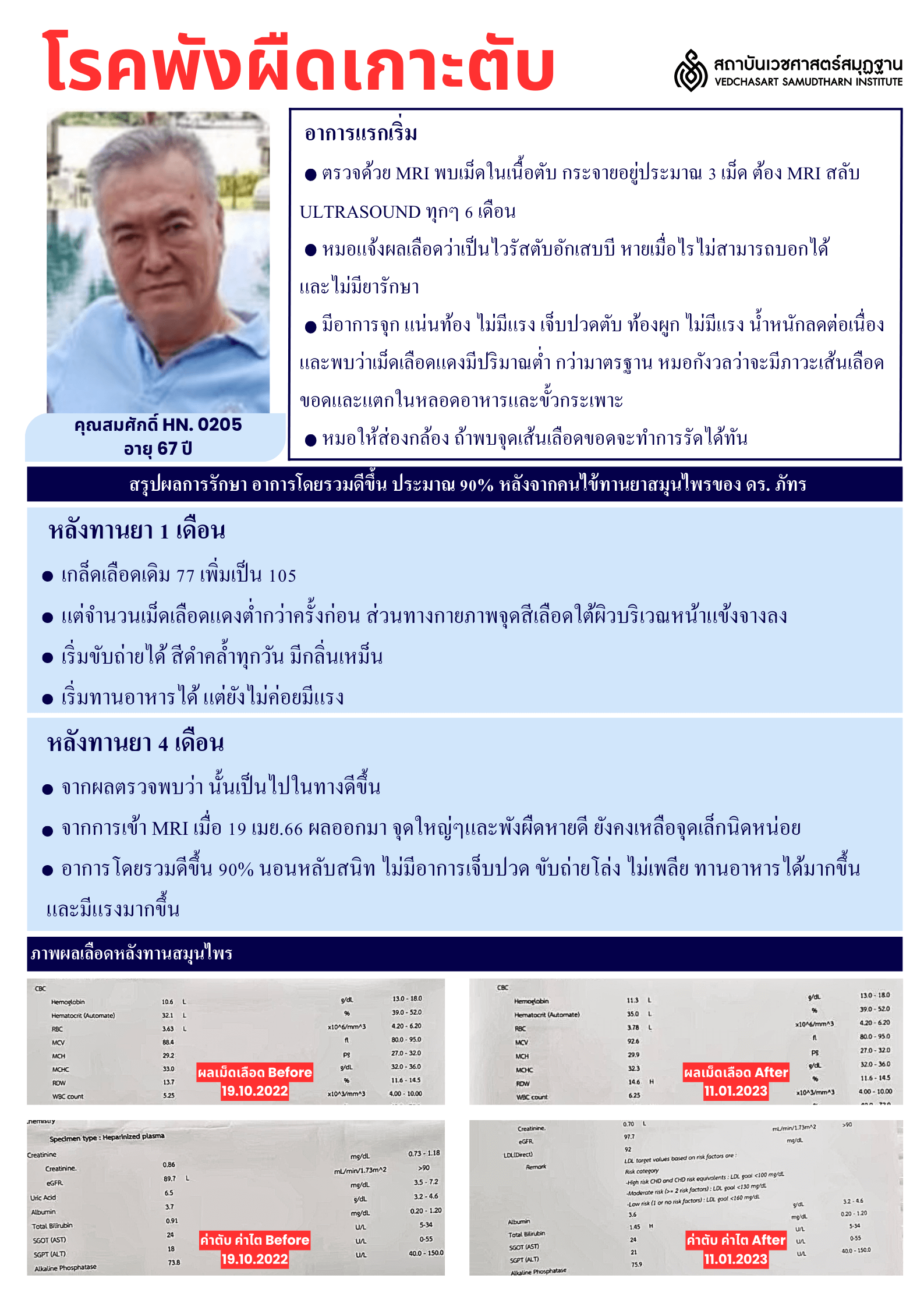 ศูนย์มะเร็ง ดร.ภัทร์ - DR.Part Cancer Center